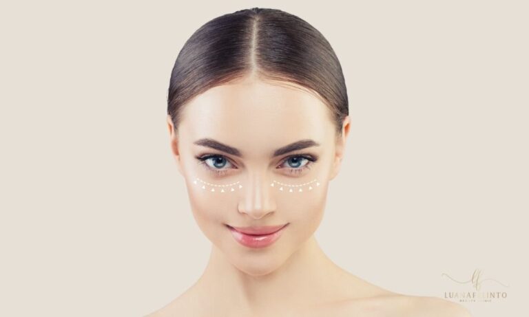 Ultra Malar Mound - Luana Felinto Beauty Clinic